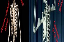 All skeletons are equal, but some skeletons are more equal than others.